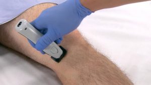 The Basic Principle of Perioperative Hair Removal Practices. | HKPHOTO